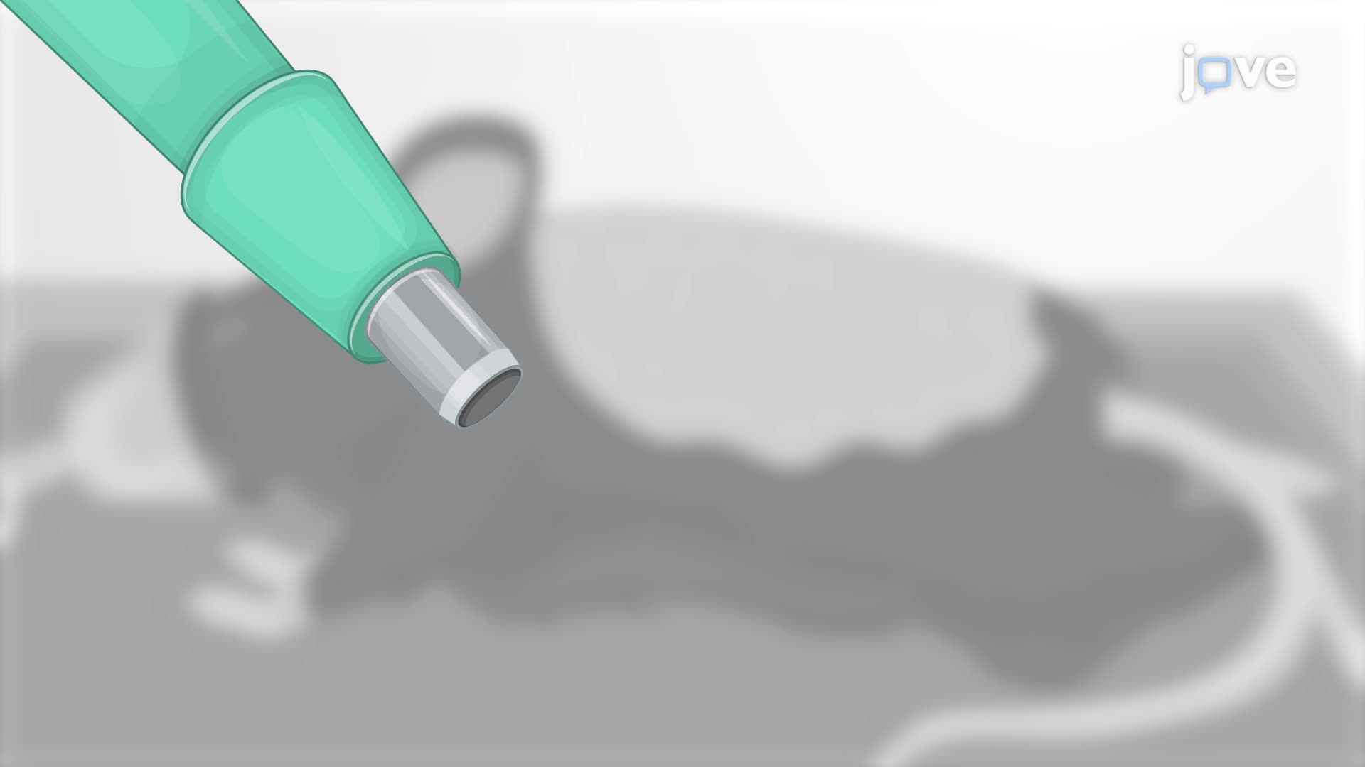 Punch Biopsy Vs Excisional Biopsy At Olivia Quinn Blog Punch Biopsy Vs Excisional Biopsy At Olivia Quinn Blog