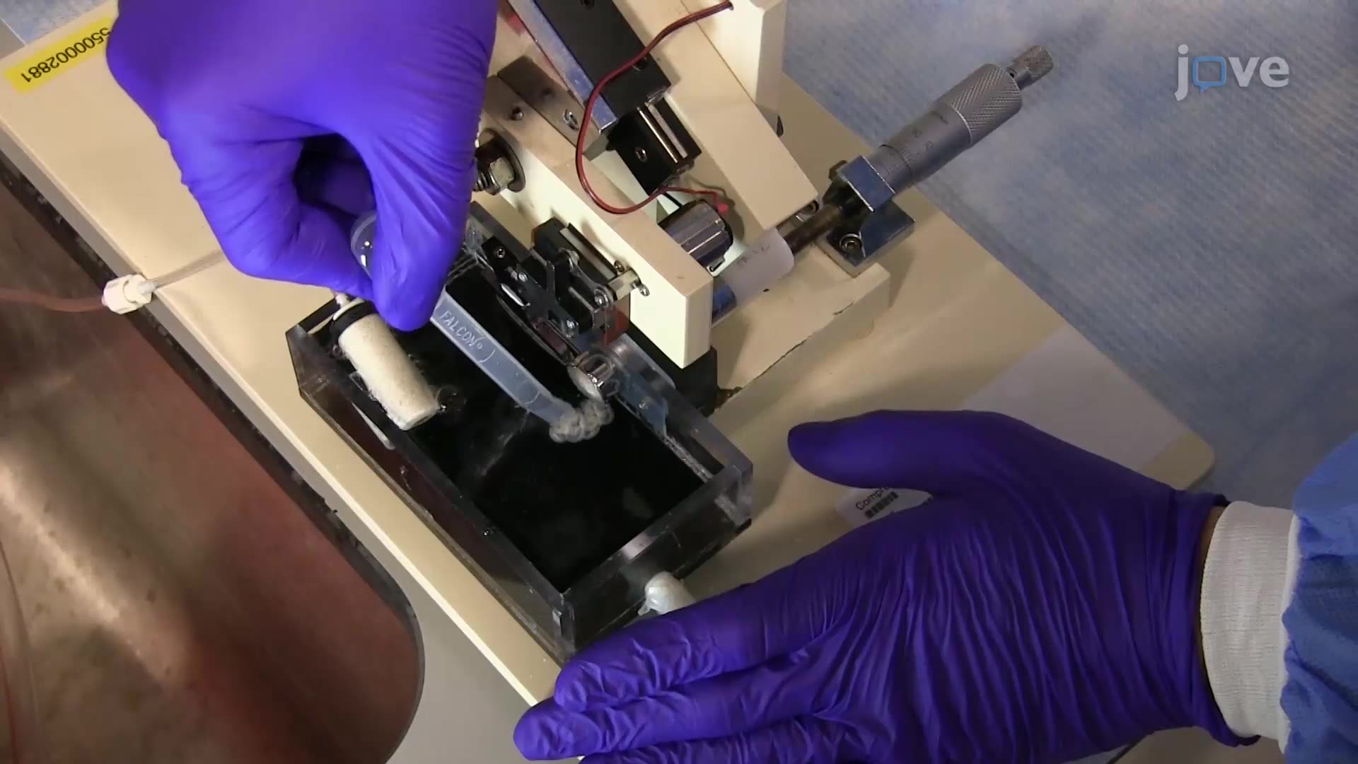 Video: NMDG Tabanlı Koruyucu Kurtarma Yöntemi Kullanılarak Beyin ...