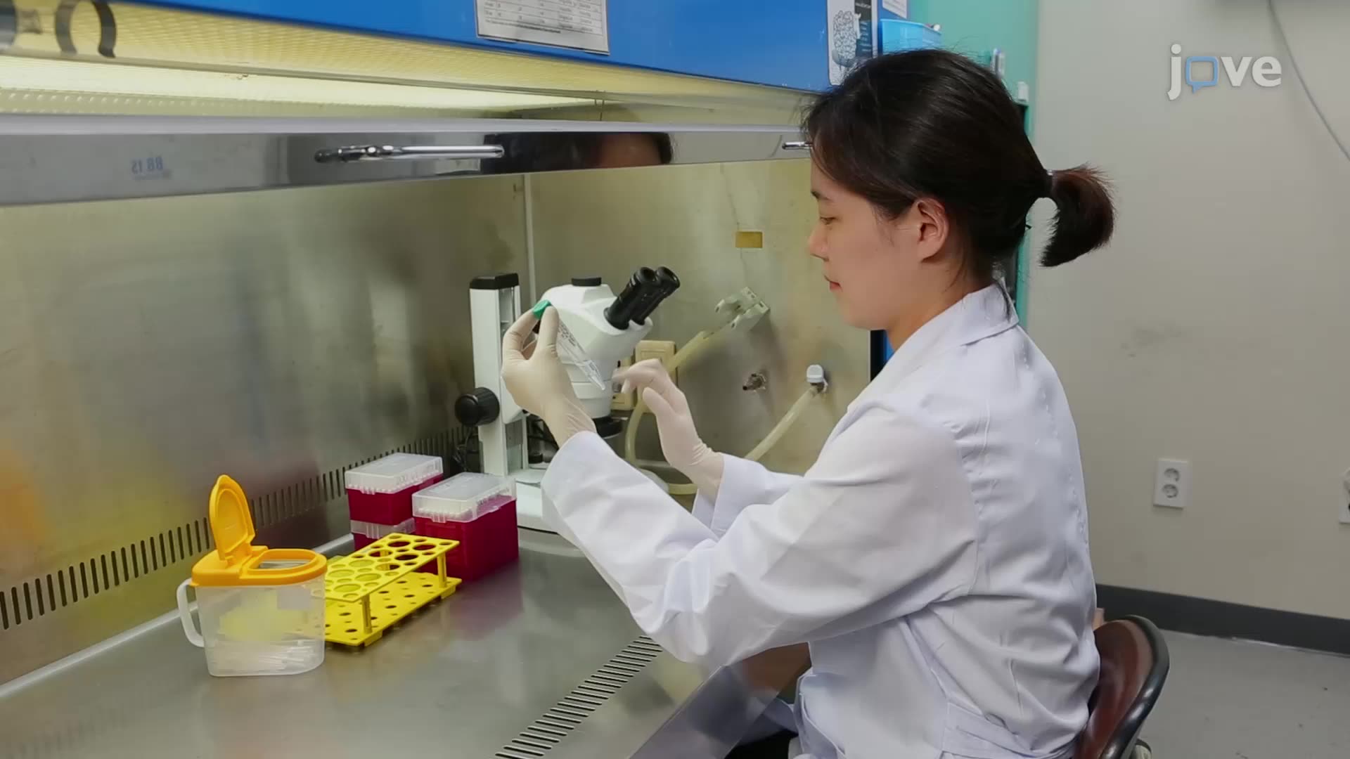 Isolation and Culturing of Adult Neural Stem Cells from the Mouse ...