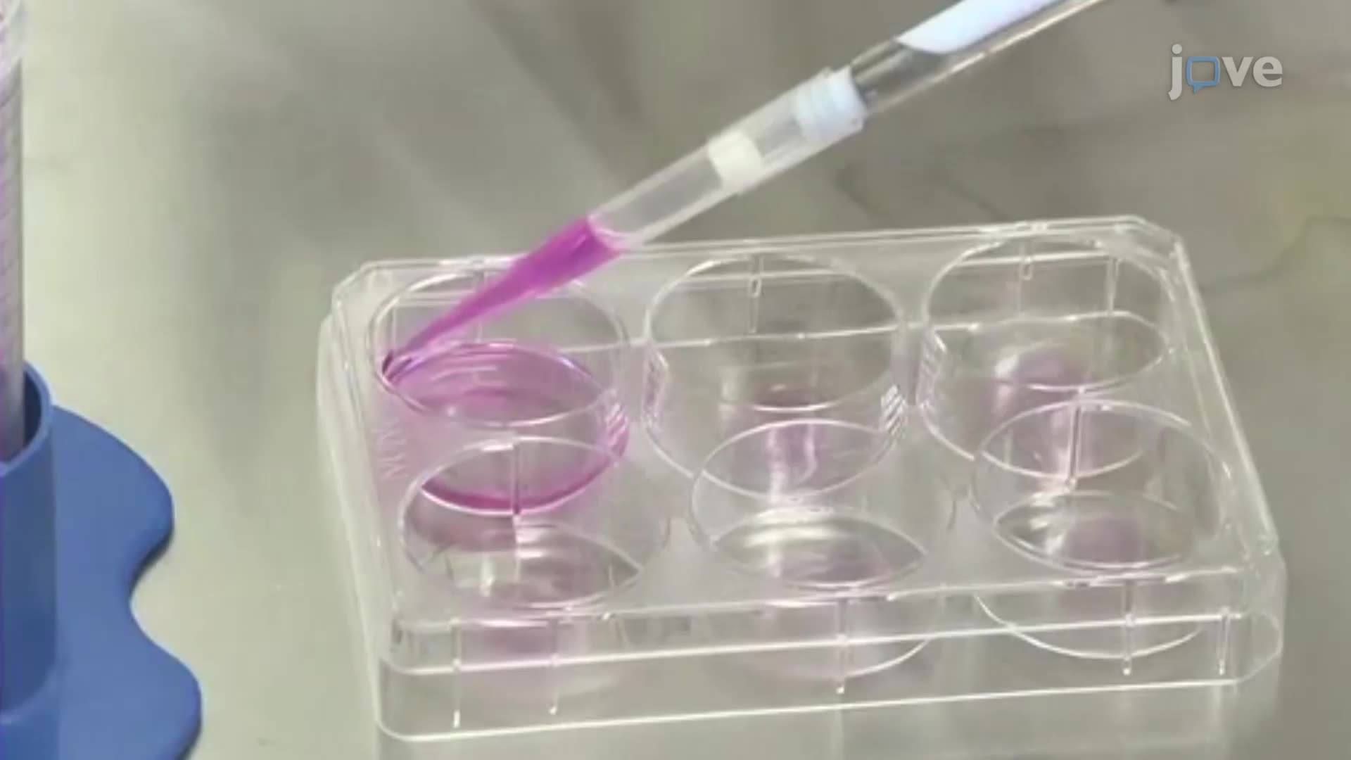 Vidéo: Un test de myélinisation induite par transduction in vitro pour ...
