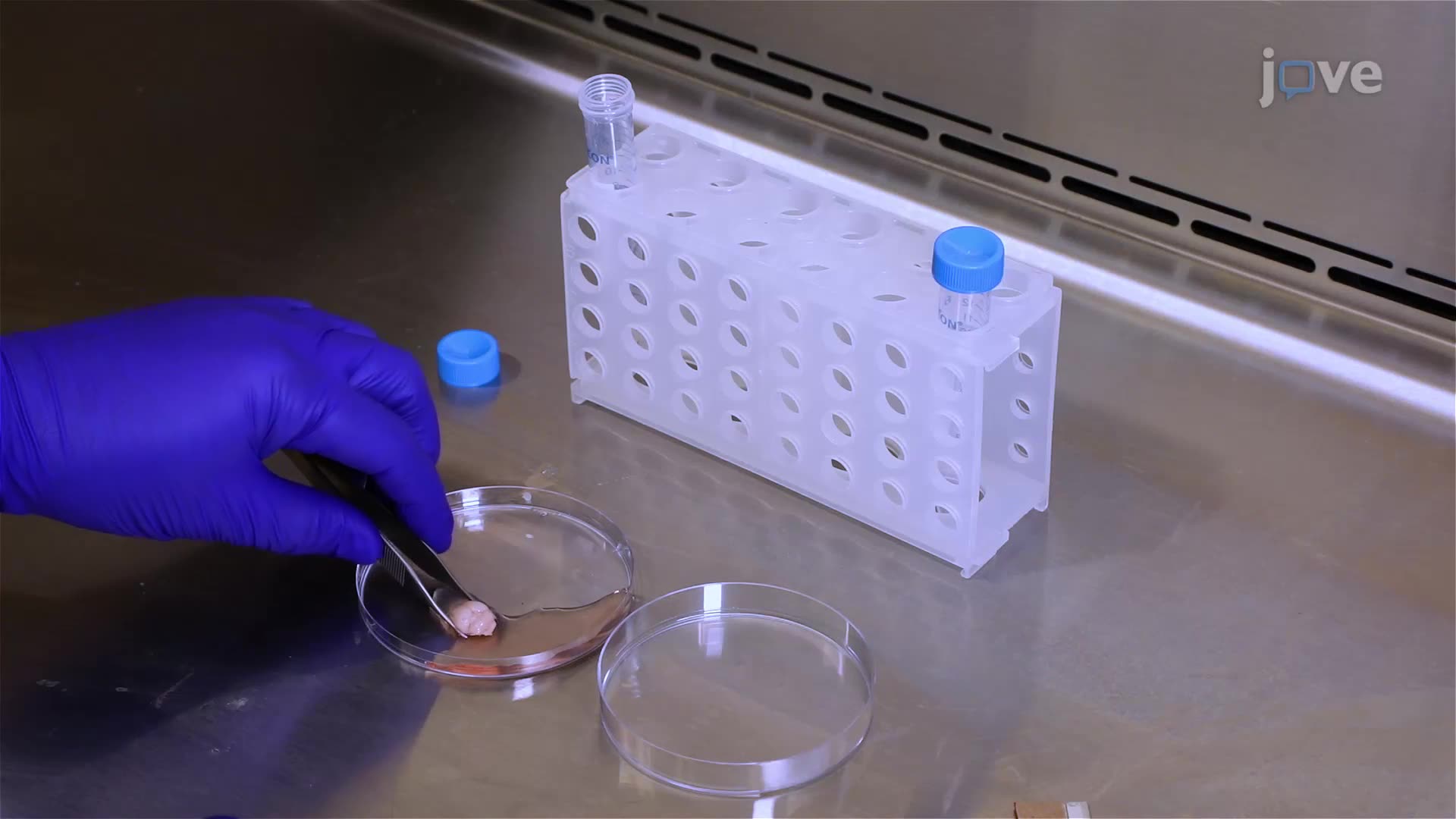 Video: Preparing a Single-Cell Suspension of Immune Cells from Murine ...