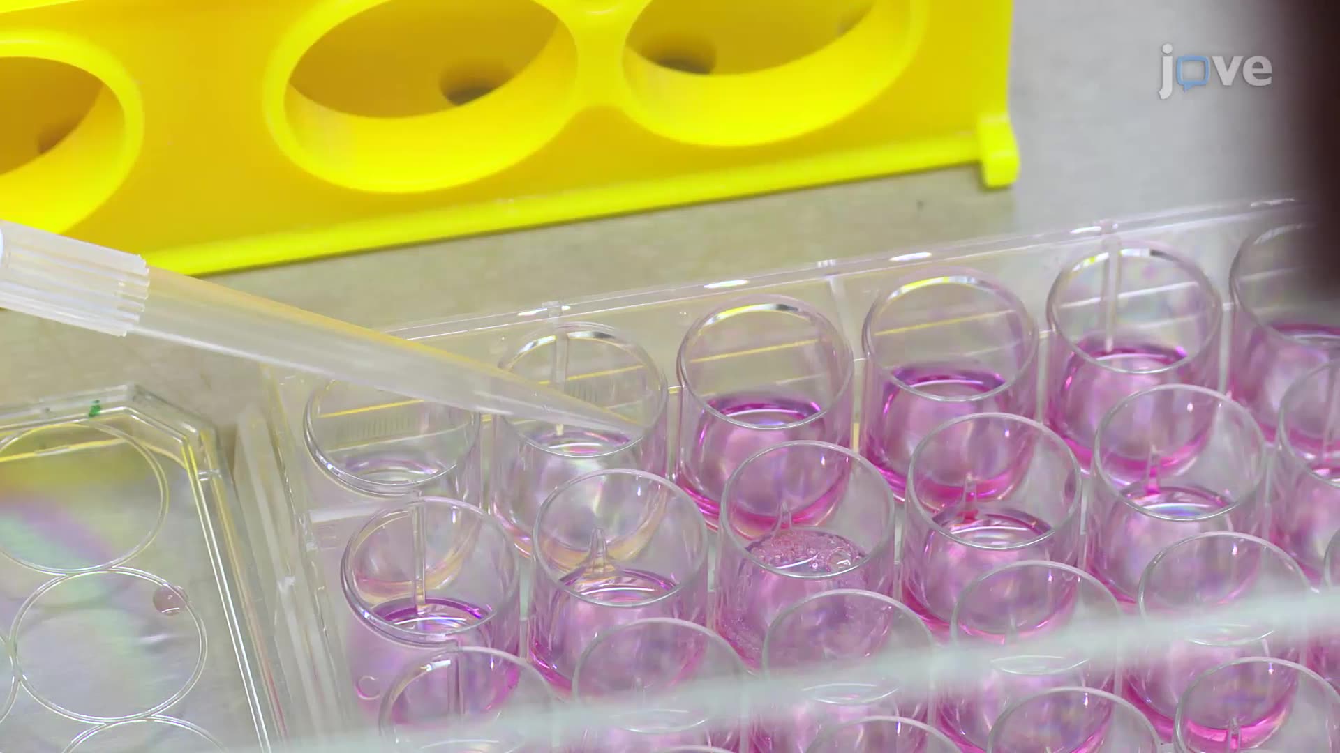 Video: Preparing Cultured Neurons for Optical Analysis of Recycled ...