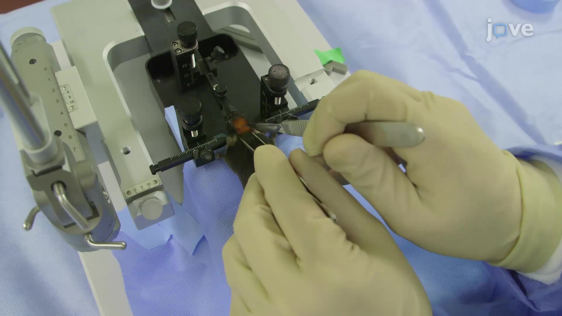 Video: Direct Stereotaxic Brain Infusion of Amyloid-Beta Proteins for ...