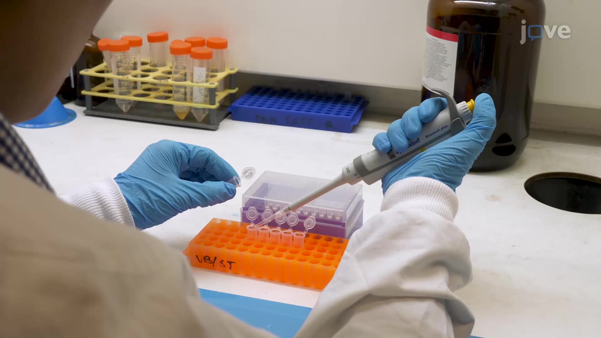 Video: Cre-LoxP Mediated Induction of Cerebral Cavernous Malformations ...