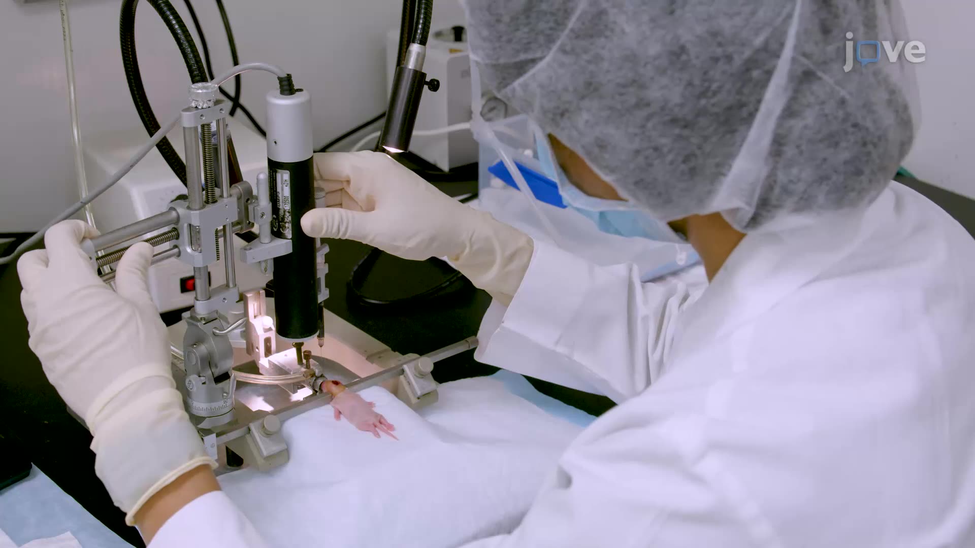 Video: Modeling Neonatal Intraventricular Hemorrhage Through ...