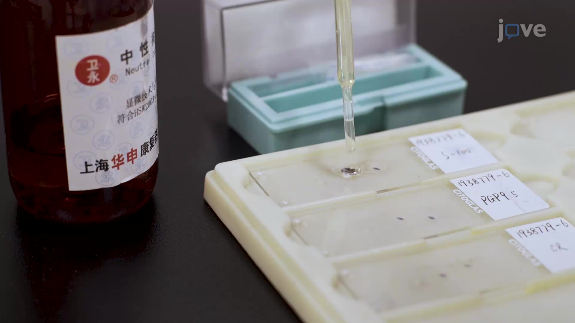 Video: Immunohistochemical Staining of S-100 Protein in Human Rectal ...