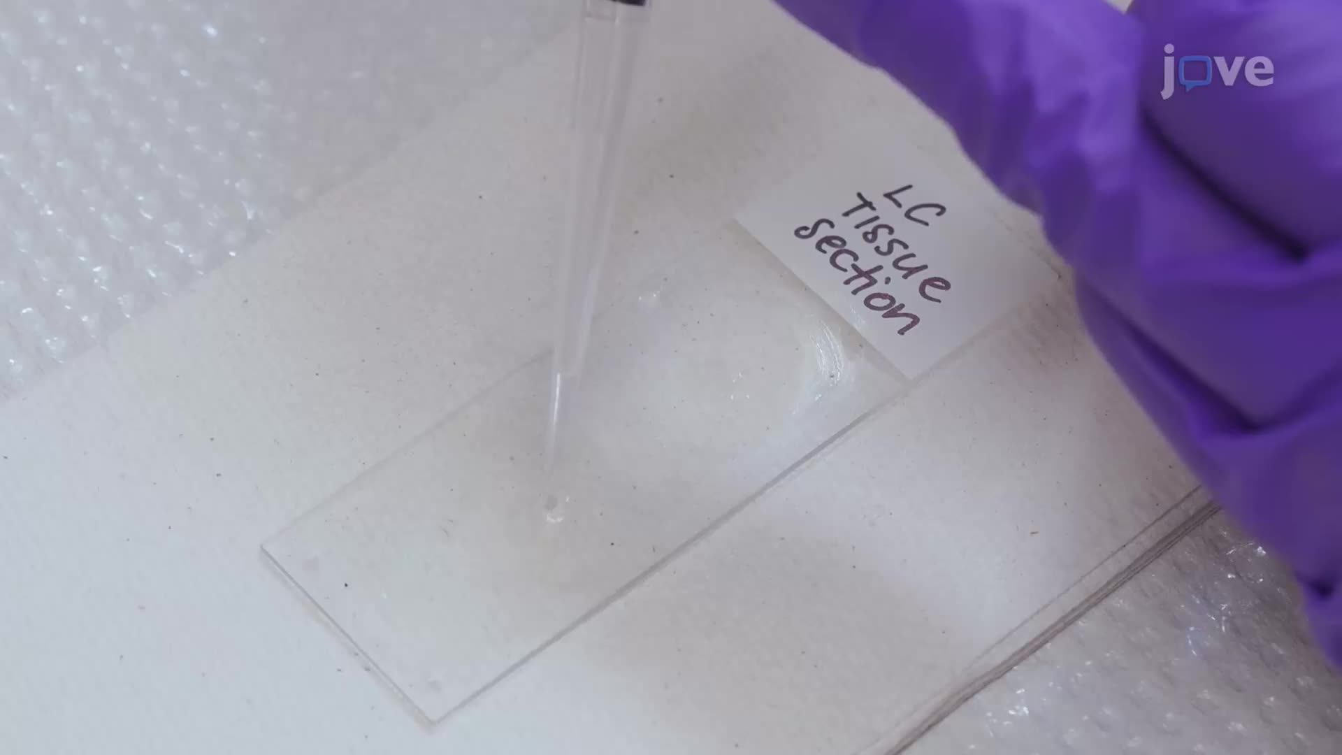 Video: Immunohistochemistry for Identifying the Locus Coeruleus Region ...