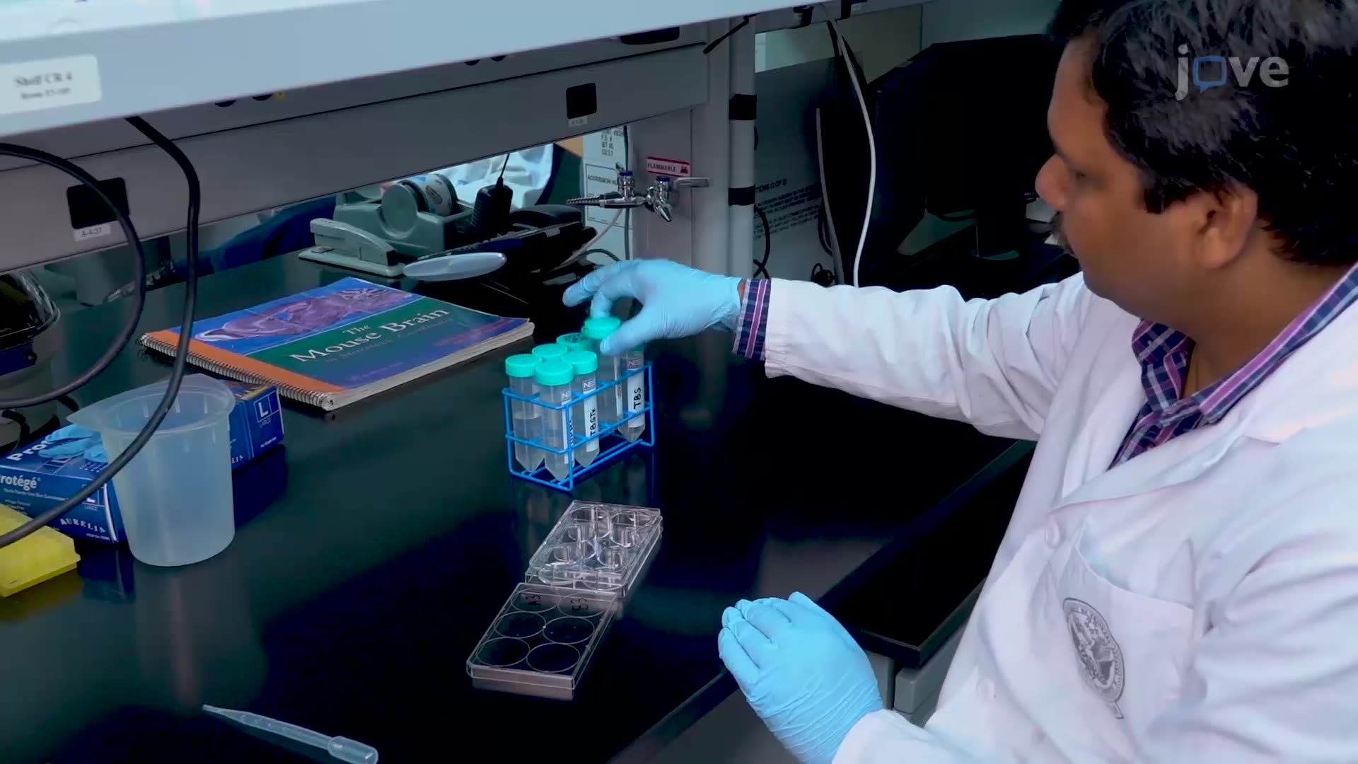 视频: Immunohistochemical Staining of Nerve Fibers in the Nucleus Basalis ...