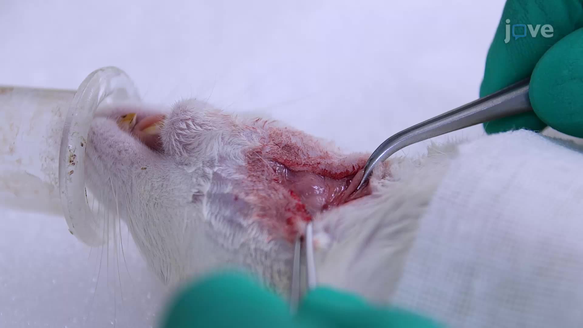 视频: 使用螺纹螺栓通过大脑中动脉闭塞诱发缺血性中风 - 实验