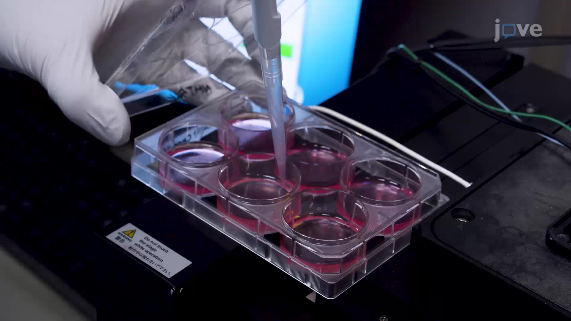 Video: Assessing Muscle Contraction with Neuromuscular Blocker ...