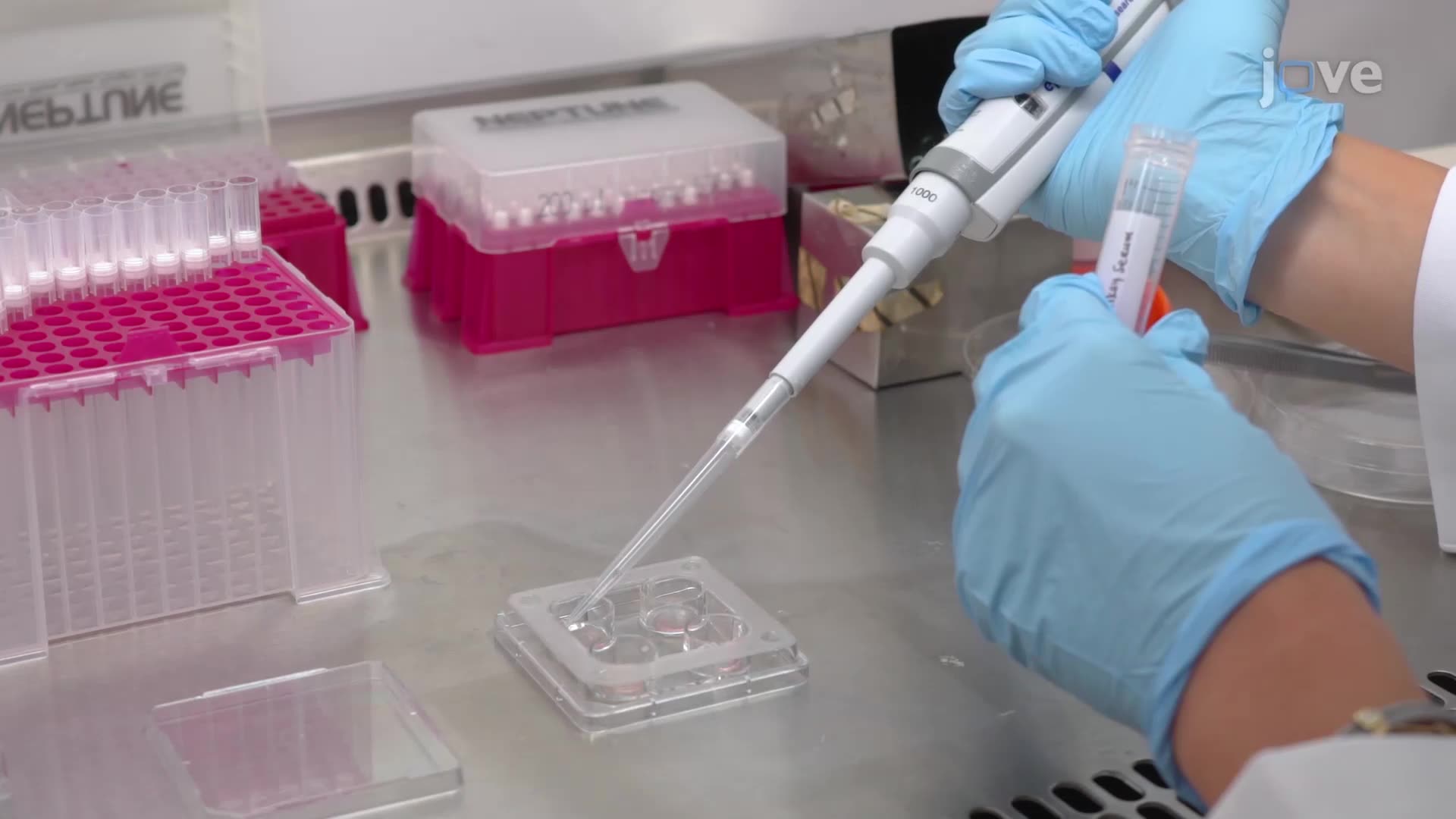 Video: Fluorescence Staining of Neural Crest Cells Cultured on ...