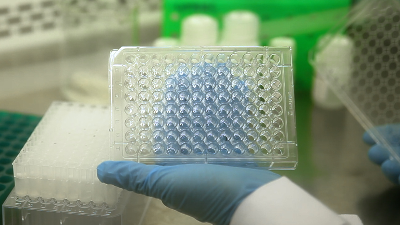 MiR-15a exosomal derivado de la lágrima como nueva herramienta ...