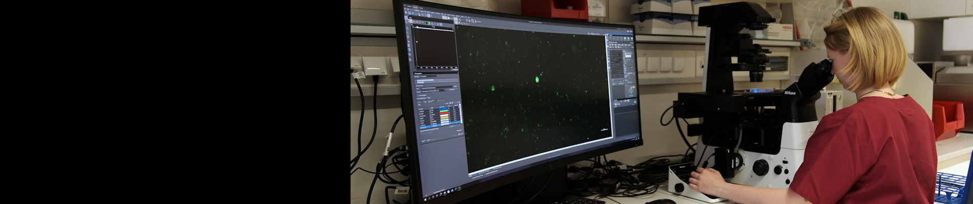 Series: Follicular Viability Assessment in Vitrified Human Ovarian ...