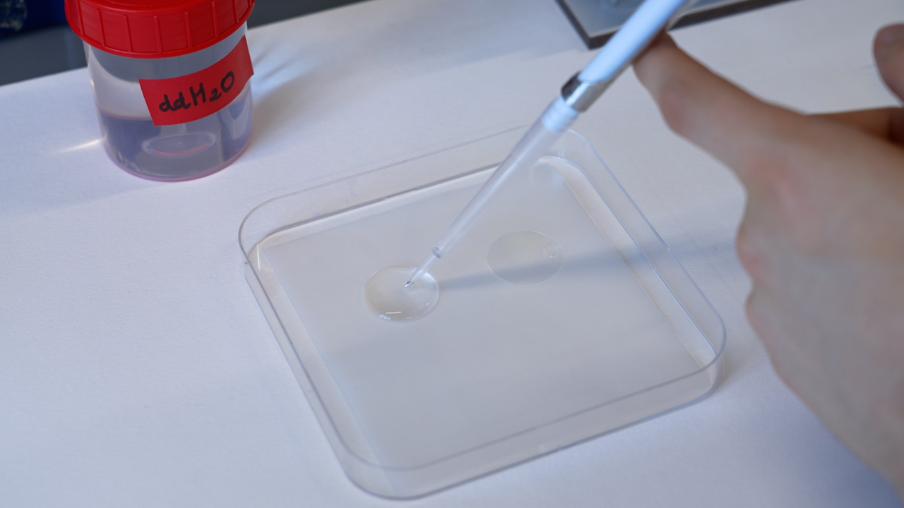 Serie: Expansionsmikroskopie: Hochauflösende fluoreszierende Bildgebung ...