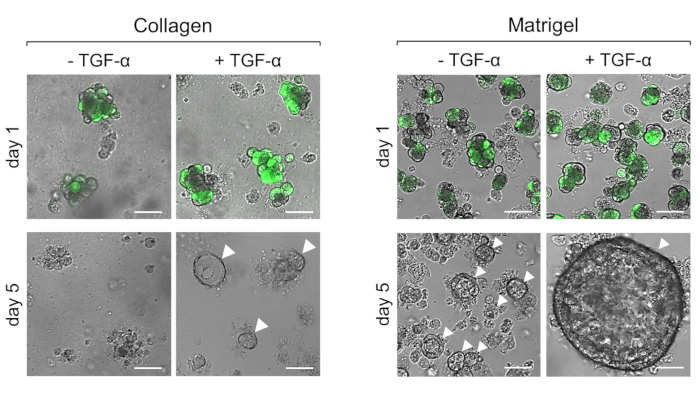 Acinar-to-Ductal Metaplasia Induction: A Method to Study Acinar Cell to ...