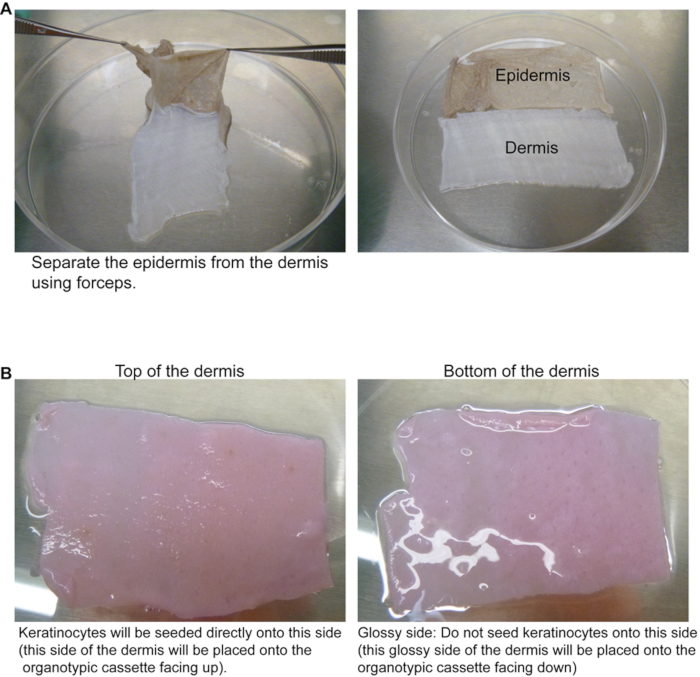 Organotypic 3D Skin Culture: A Cassette-based In Vitro Culture ...