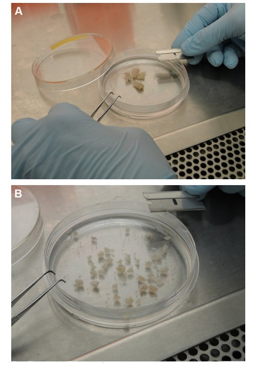 Obtaining Primary Ovarian Cancer Cells from Solid Specimens: A Method ...