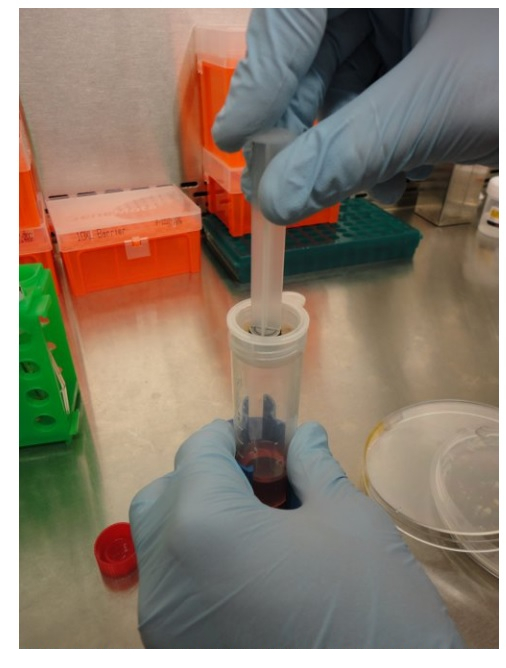 Obtaining Primary Ovarian Cancer Cells from Solid Specimens: A Method ...