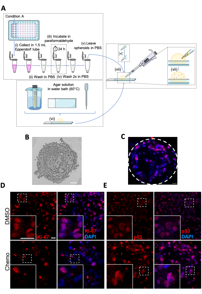 Embedding 3D Spheroids in Agarose Gel Drops: A Technique to Preserve Spheroids for Downstream ...