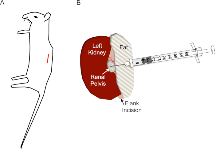 Hydrodynamic Renal Pelvis Injection: A Technique to Directly Deliver ...