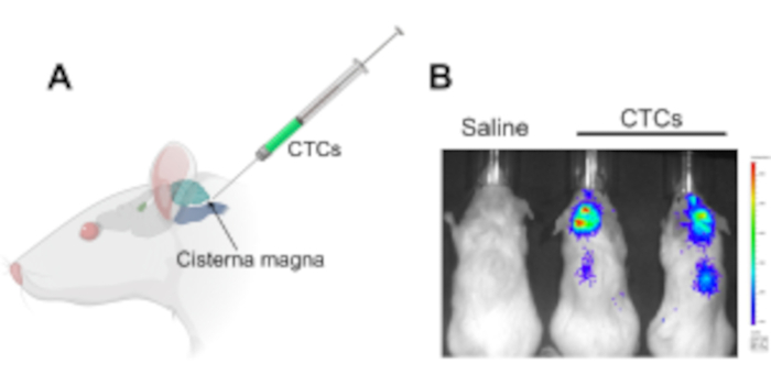 Surgical Cisterna Magna Injection: A Method for Administering Tumor ...