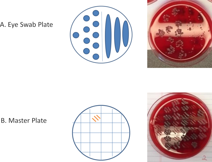 Swab-based Conjunctival Commensal Bacteria Isolation: A Technique to ...