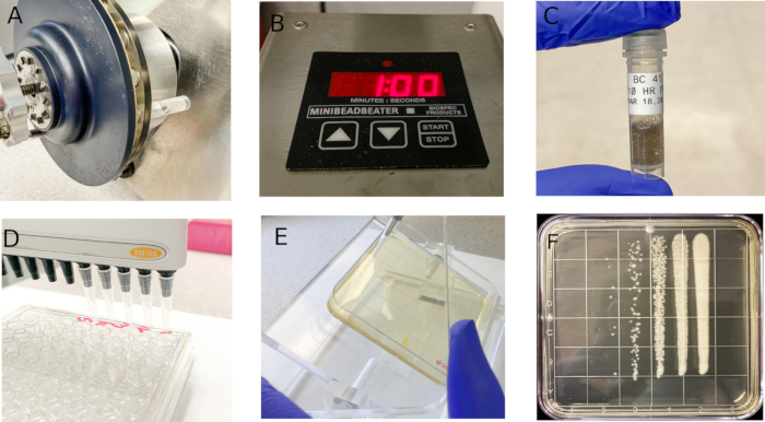 Bacterial Infection Quantitation Assay: A Method to Quantify ...