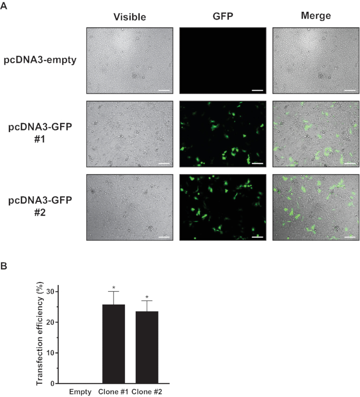 Inducible Tet-Off Regulatable System: An In Vitro Method to Modulate ...