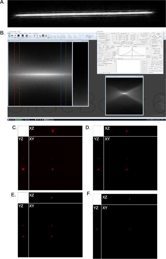 Lattice Light Sheet Microscopy to Visualize Receptor-Ligand ...