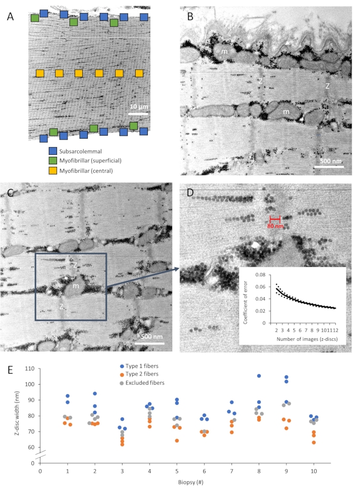 Transmission Electron Microscopy to Quantify Glycogen Distribution in ...