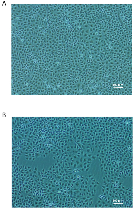 A Microneutralization Assay to Measure Neutralizing Antibody Titers in ...
