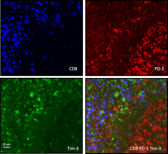Multiplexed Immunofluorescence Imaging to Analyze Immunotherapy ...