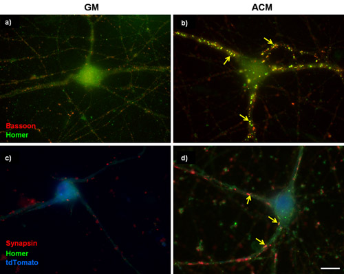 Quantifying Synapses: an Immunocytochemistry-based Assay to Quantify ...