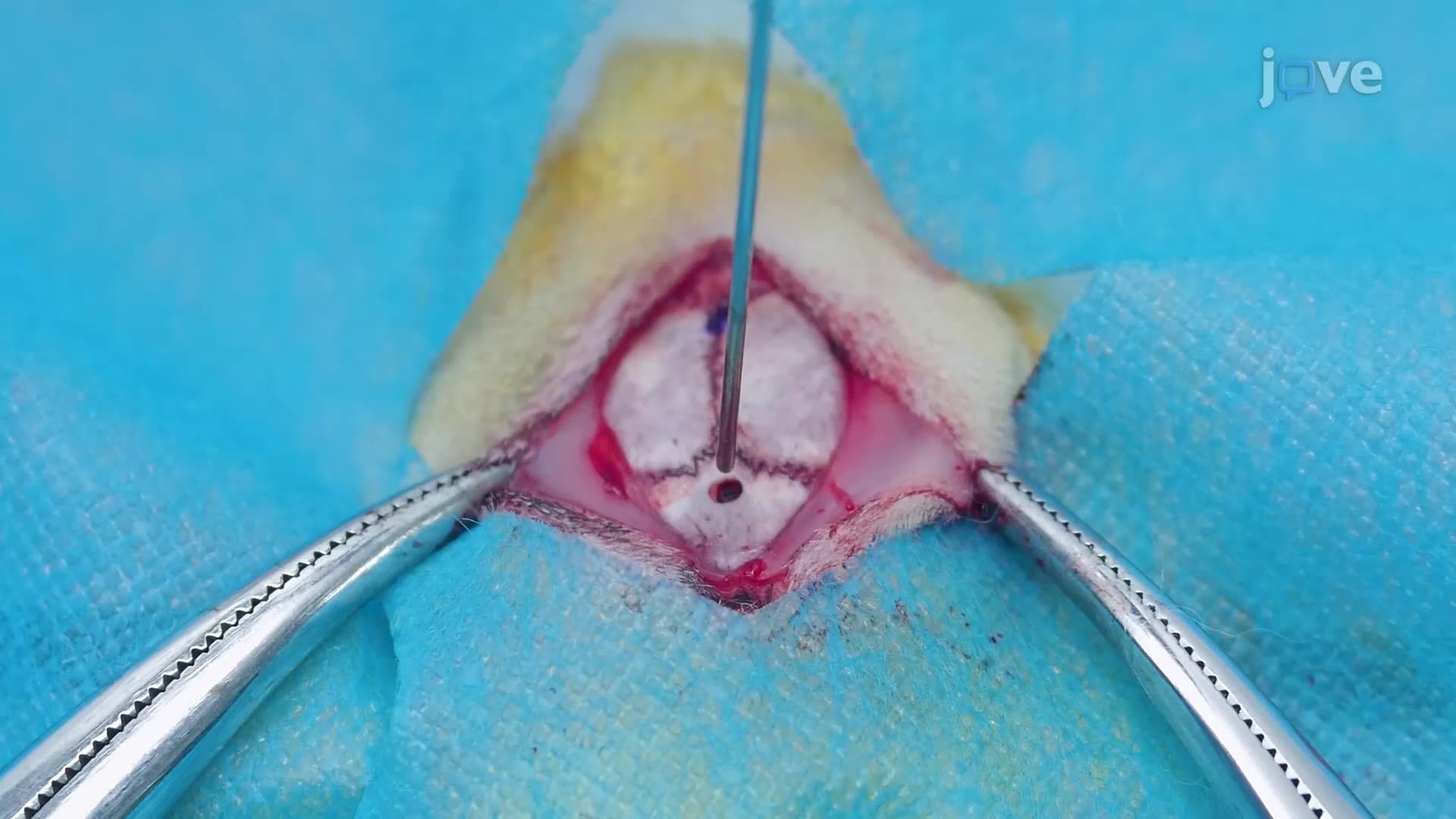 Video: Inducing Massive Pontine Hemorrhage in a Rat Model by Autologous ...