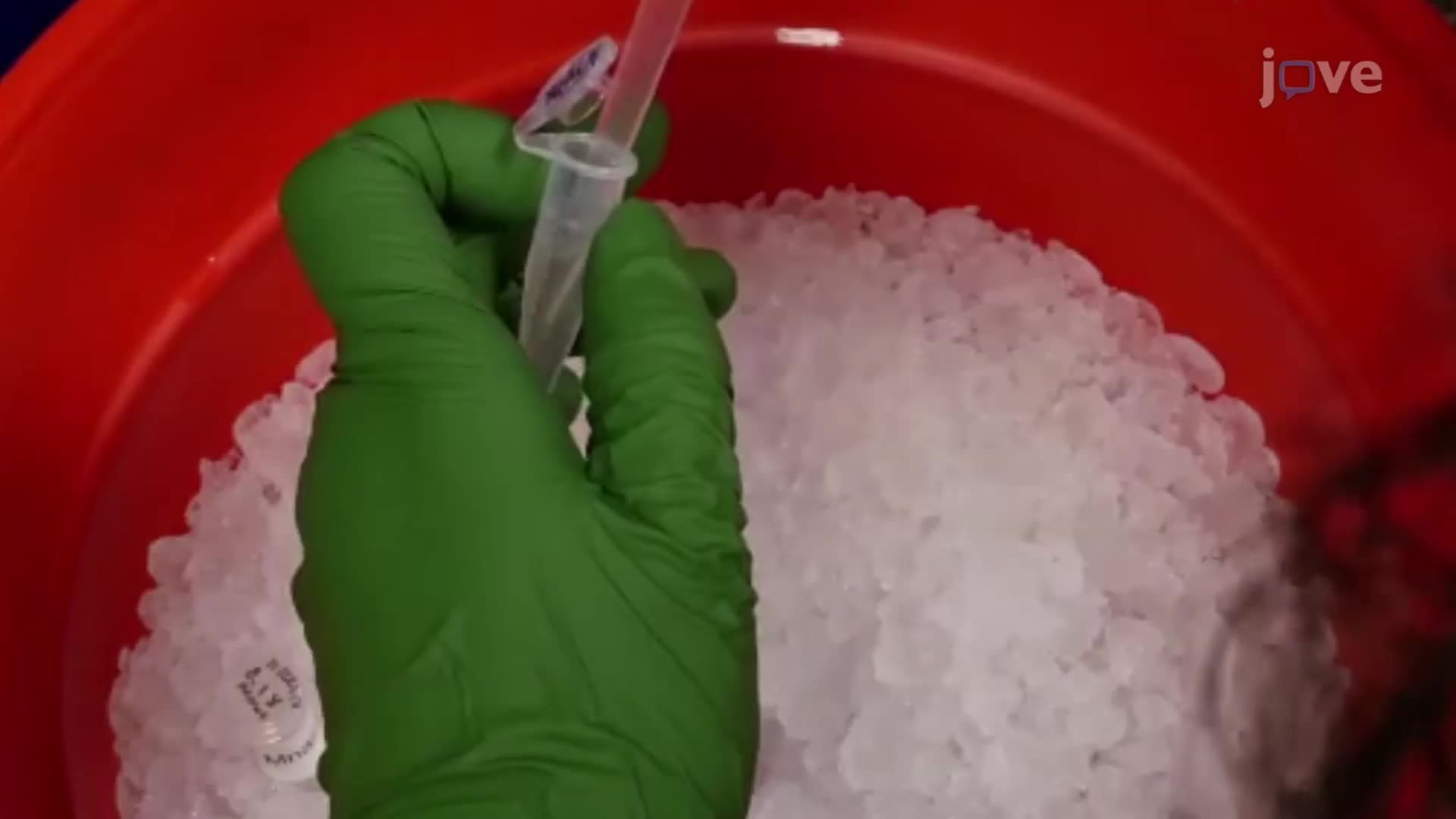 Video: Native Chromatin Immunoprecipitation of Neurosphere Cells ...