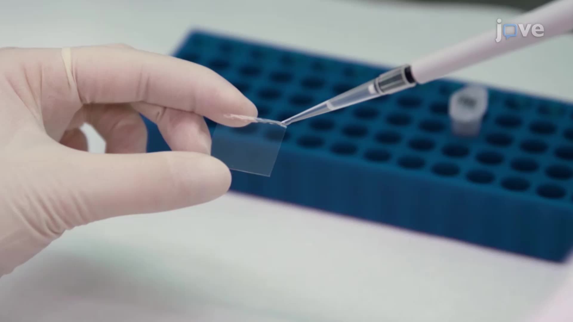 Video: Immunofluorescence Staining of Gel-Embedded Patient-Derived ...