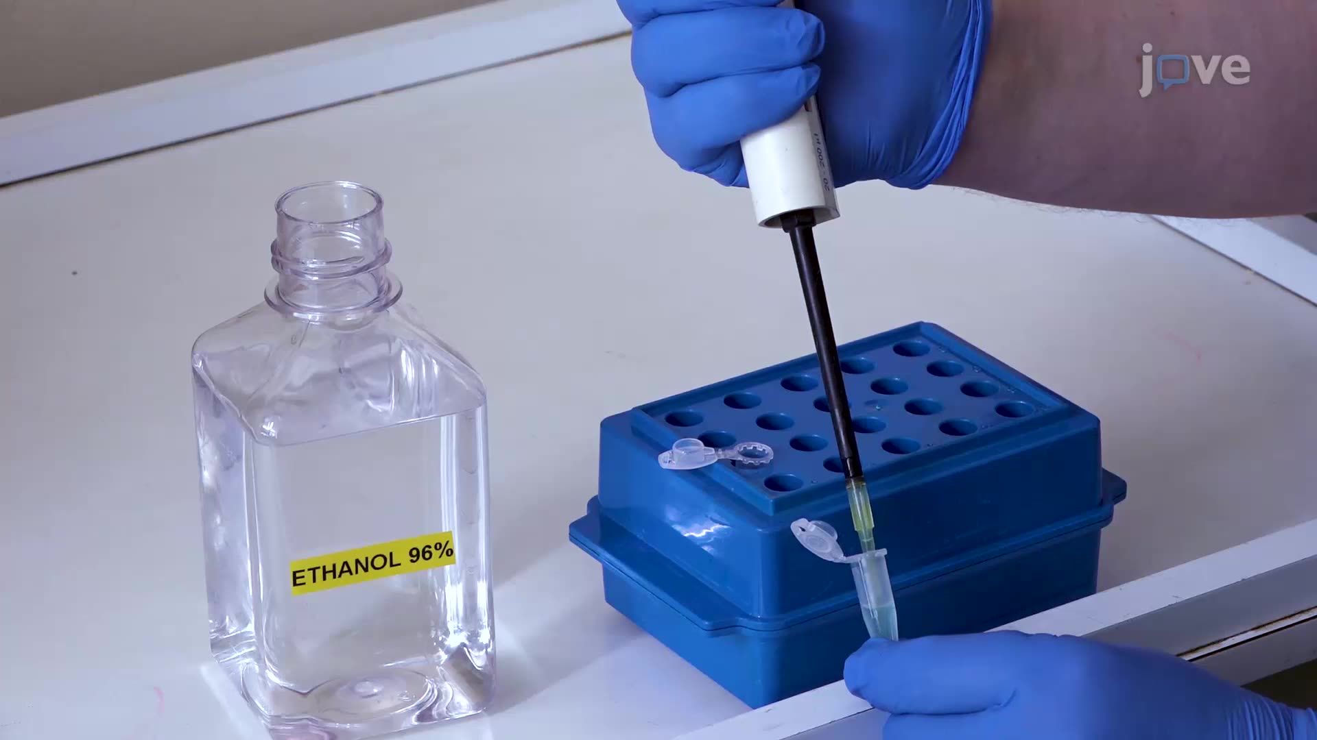 Video: Assessing Blood-Brain Barrier Integrity in a Laser-Induced Brain ...