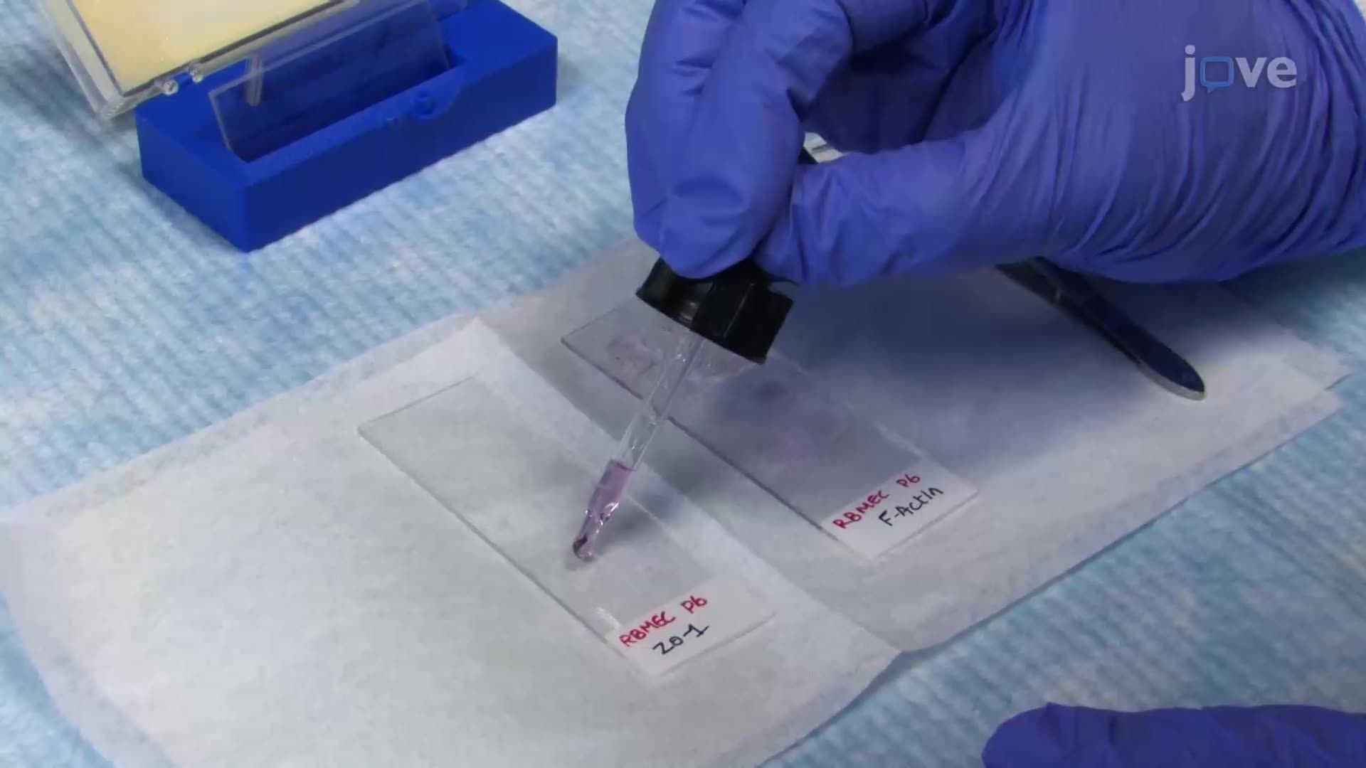 Video: Fluorescence Localization of Tight Junction Proteins and Stress ...