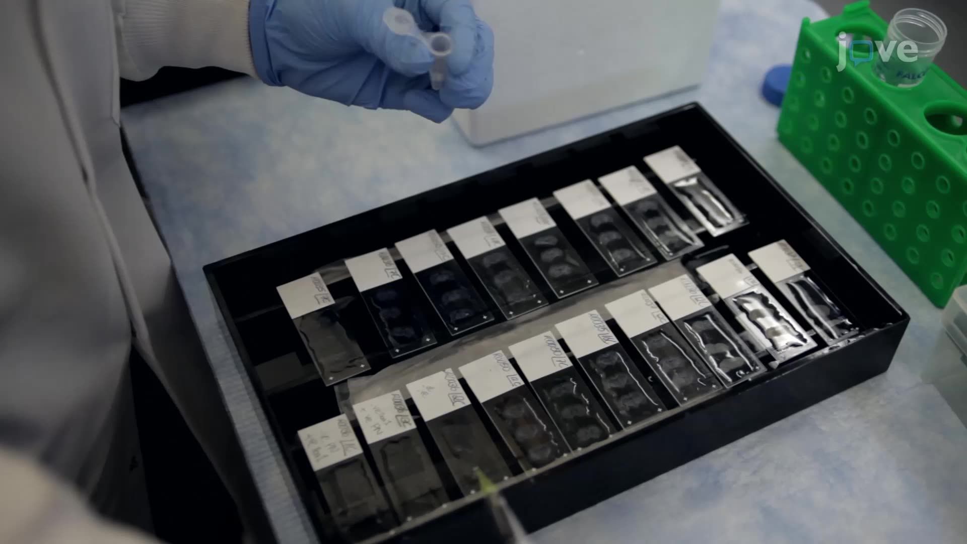 Video: Immunohistochemical Staining of Rat Coronal Tissue Cryosections ...