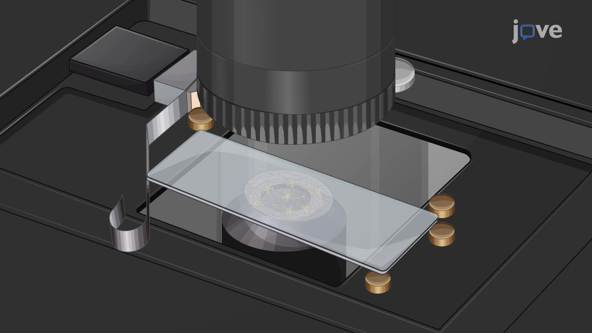 Dekonvolüsyon Mikroskobu Kullanılarak Fare Primer Hipotalamik Nöronlarında GLUT4 Protein ...