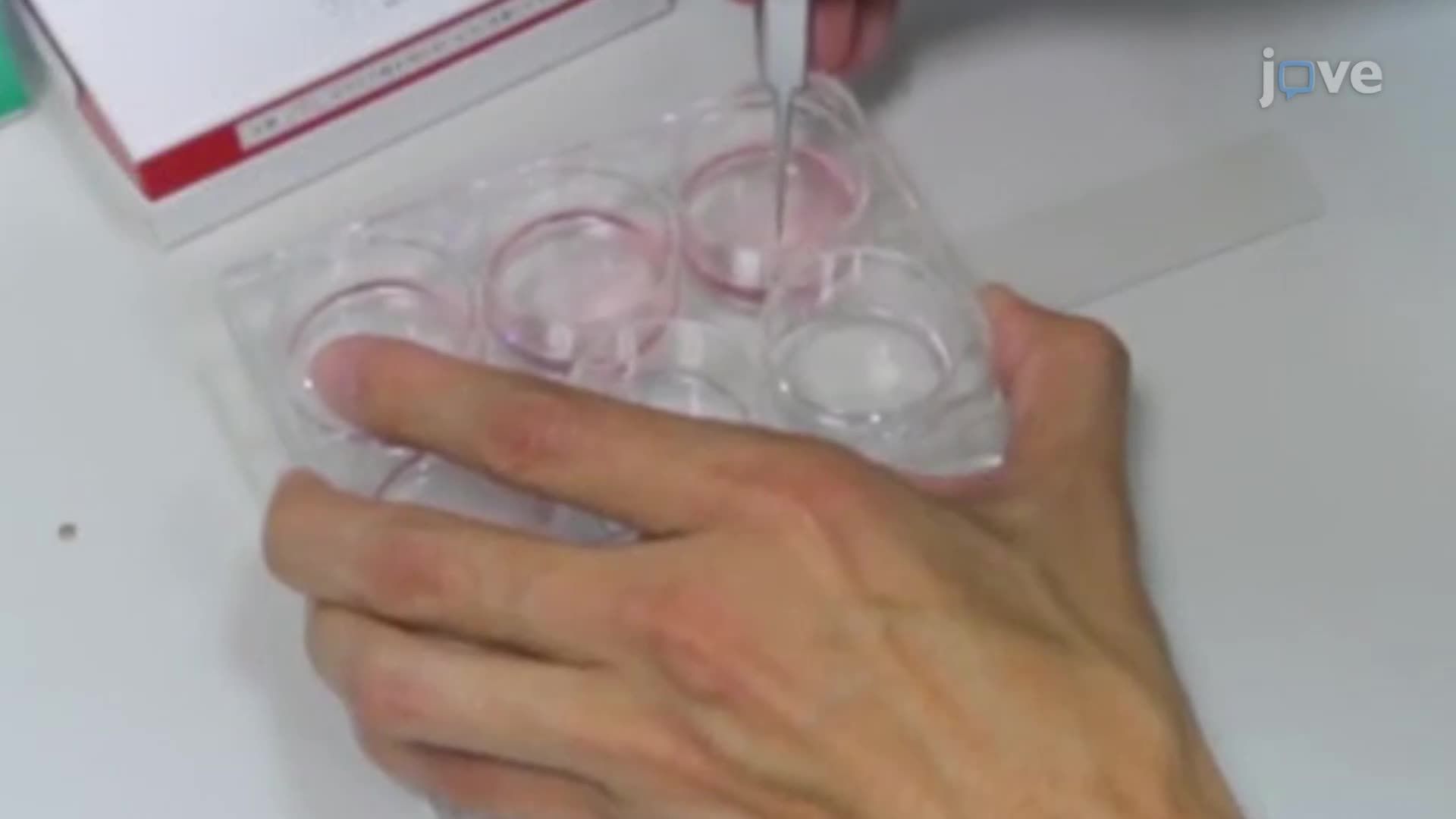 Video: Imaging GLUT4 Protein Trafficking in Mouse Primary Hypothalamic Neurons Using ...