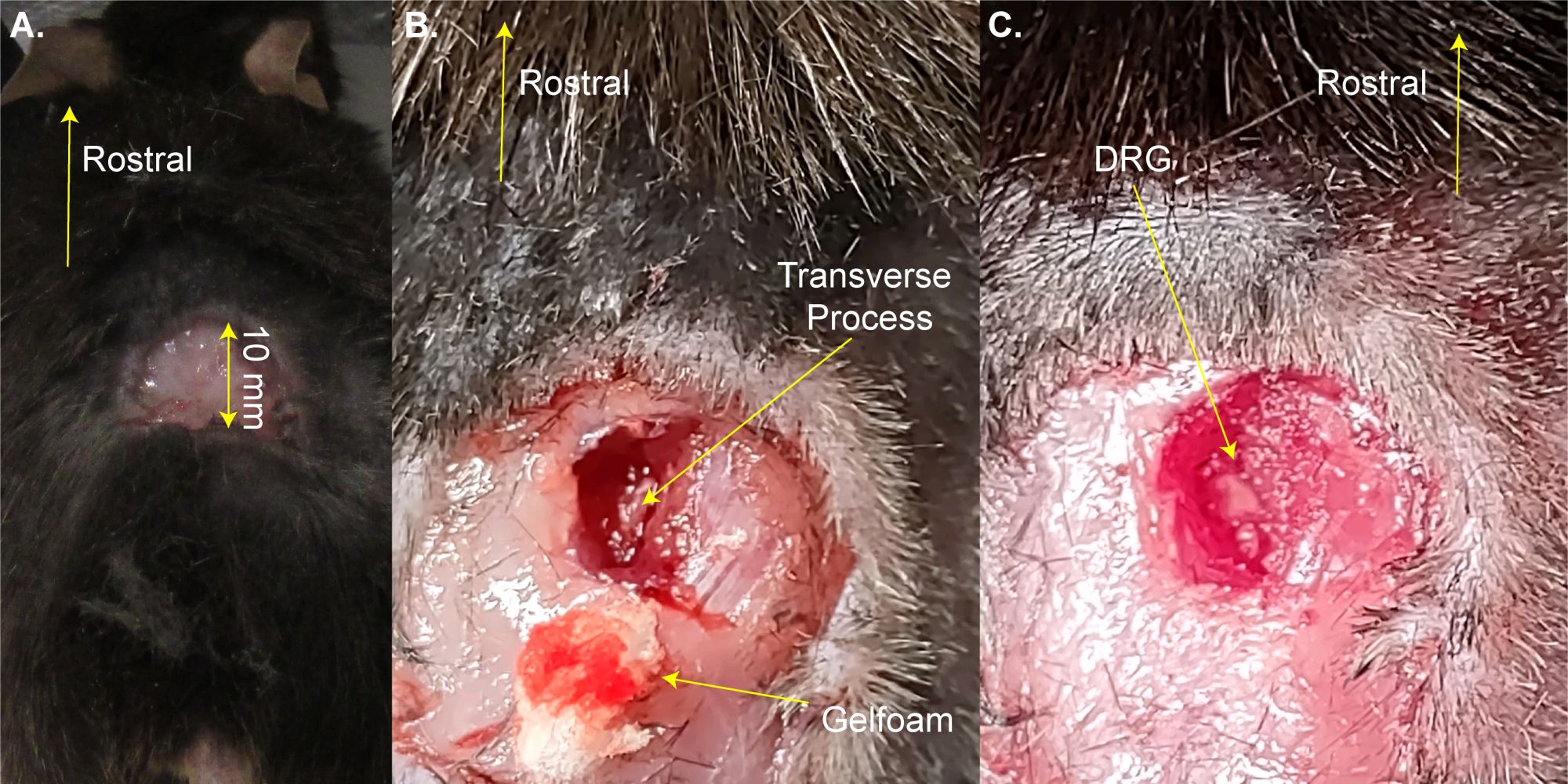 In Vivo Calcium Imaging of Neuronal Ensembles in the Intact Dorsal Root ...