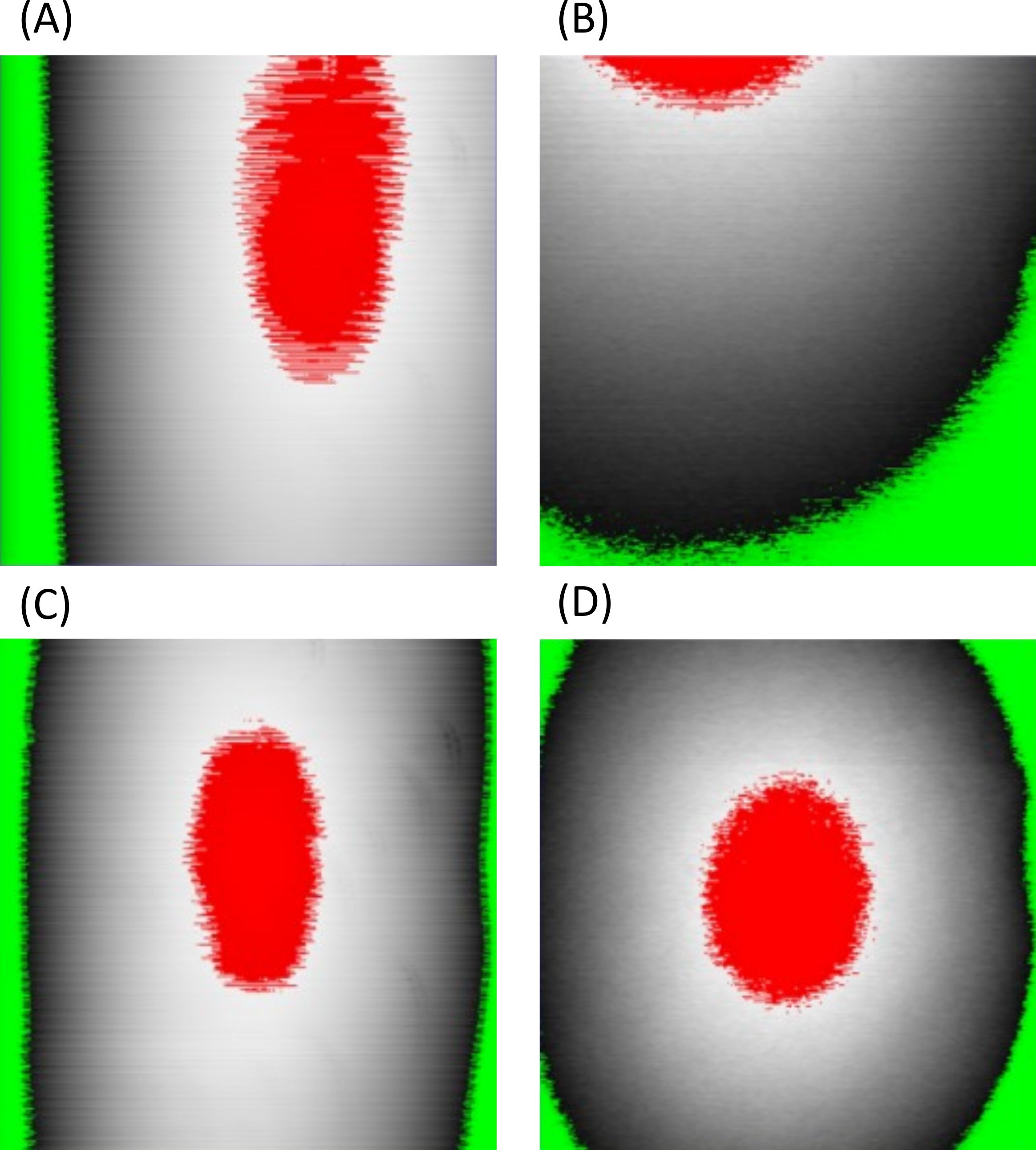 Two-Color Stimulated Raman Scattering Imaging of Mouse Brain Tissue