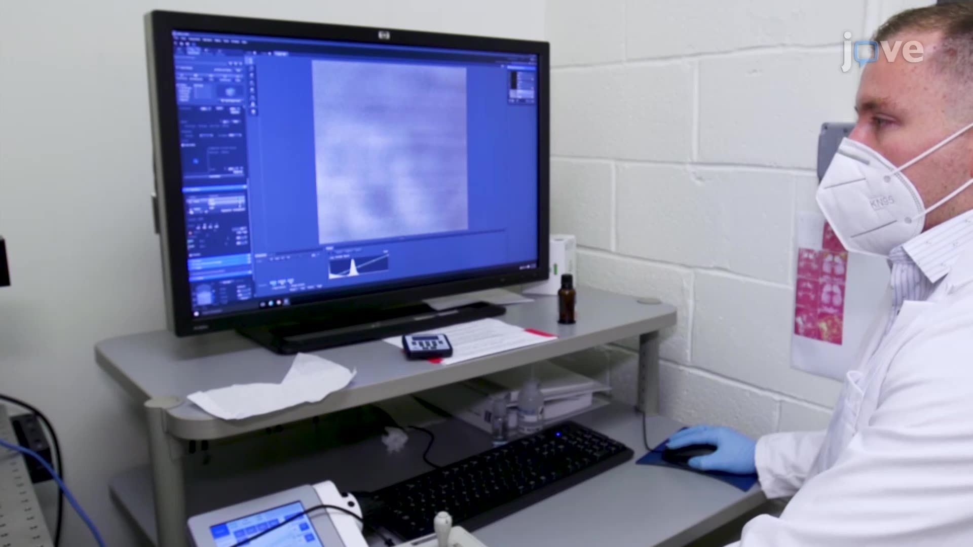 Video: Monitoring Recovery of Laser-Ablated Interneuromast Cells in ...