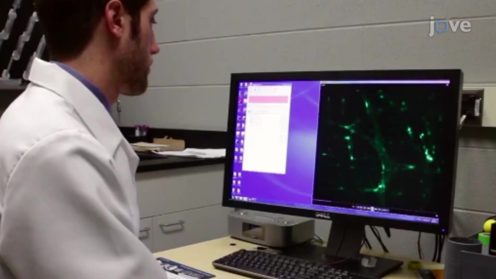 视频: Calcium Imaging of Enteric Neuron and Glia Activities in a Mouse ...