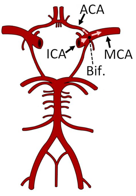 Functional Imaging of Cerebral Blood Flow Using Transcranial Doppler ...