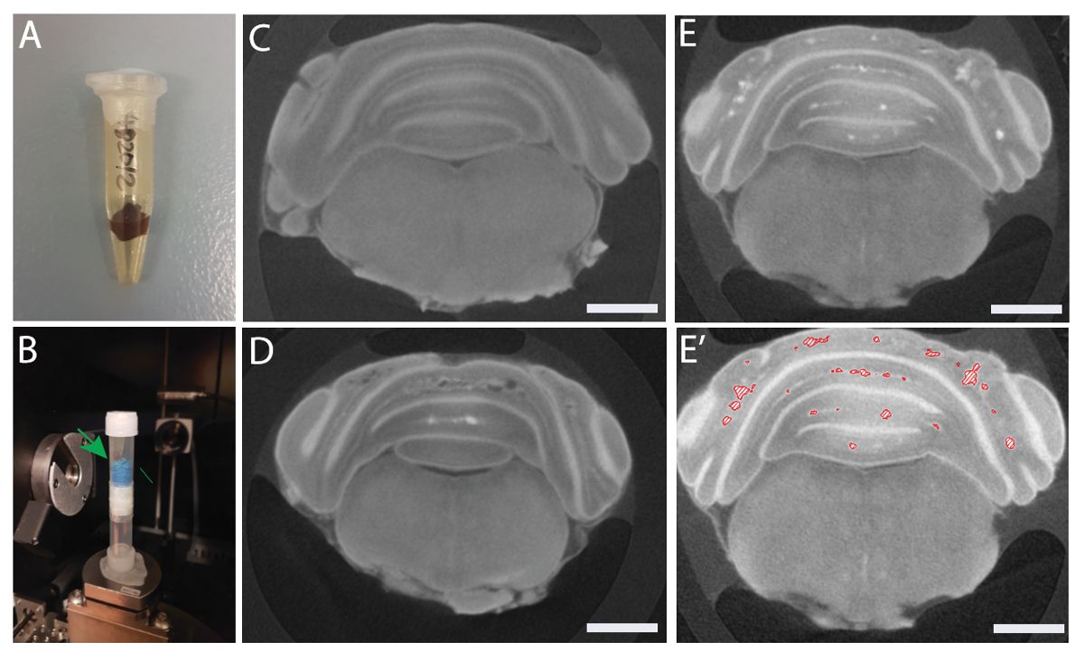 Contrast-Enhanced Micro-CT Imaging of Cerebral Cavernous Malformation ...