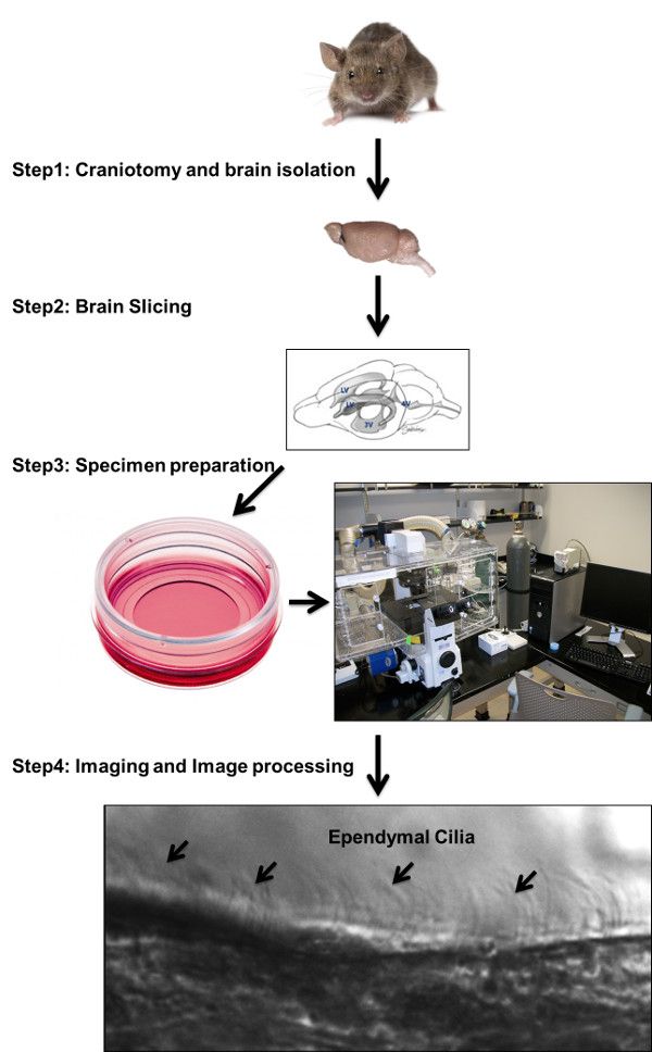 Live Imaging of Ependymal Cell Ciliary Activity in a Mouse Brain Section