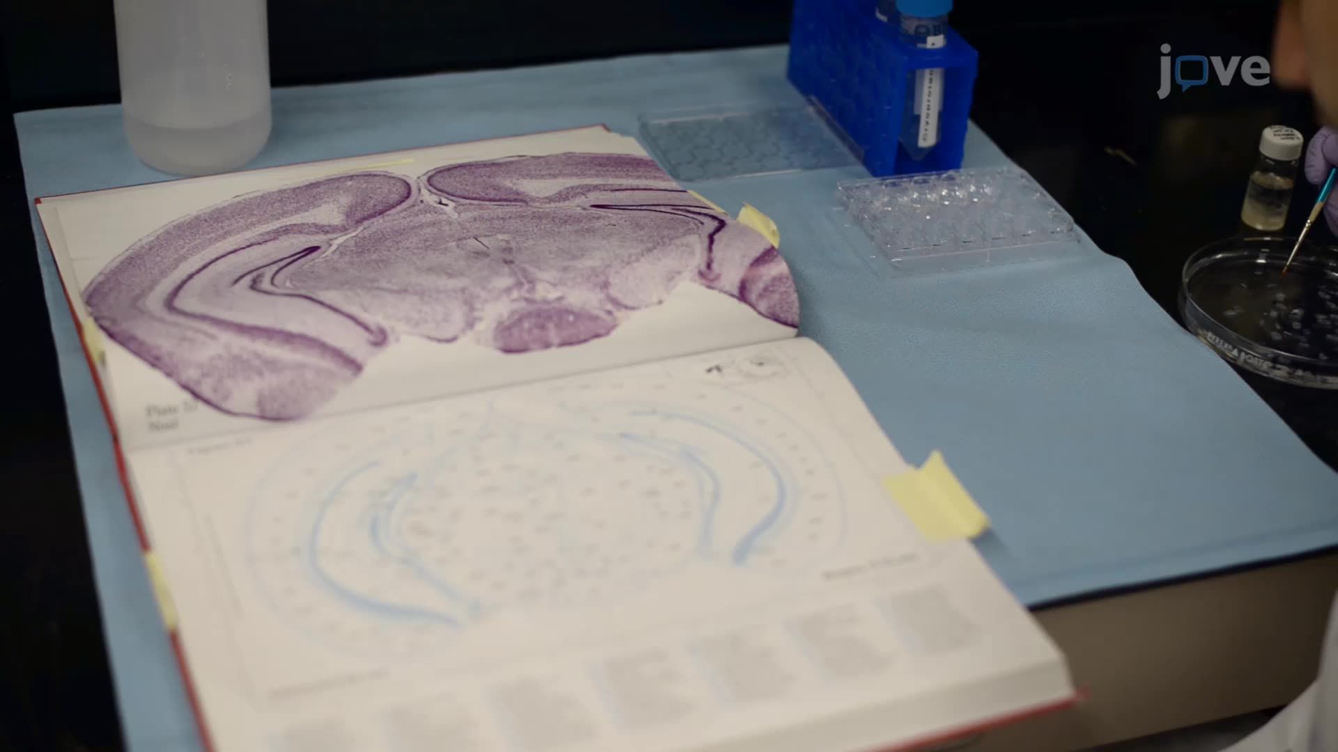 Video: Visualization and Mapping of Methoxy-X04-Labeled Amyloid Plaques ...