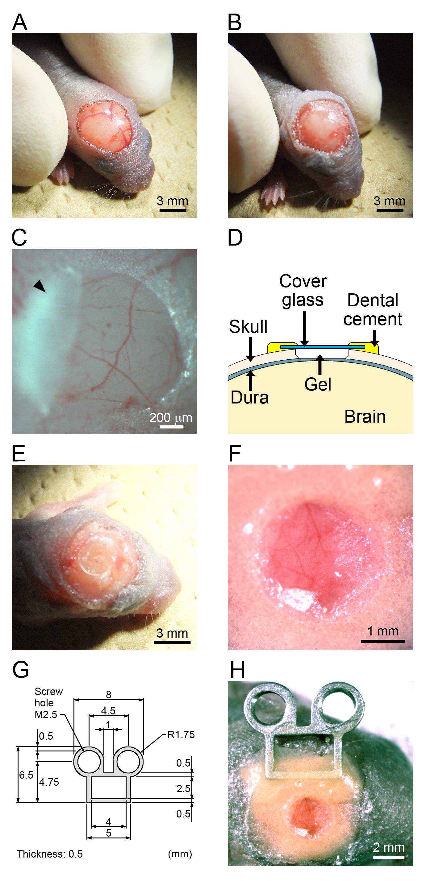 Two-Photon Microscopy for Imaging Neuronal Morphology in a Mouse Pup